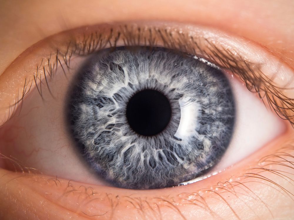 What is Heterochromia Understanding Its types And Types