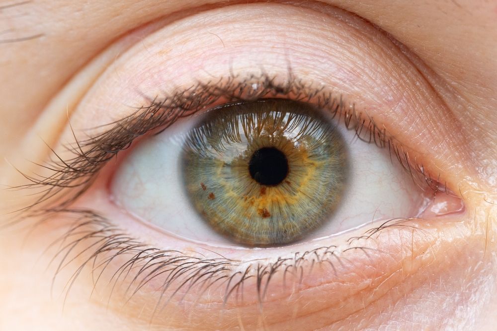 What is Heterochromia Understanding Its types And Types