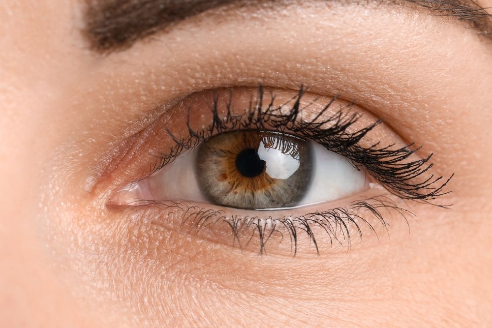 Unlocking the Enigma: Understanding Heterochromia - A Comprehensive ...