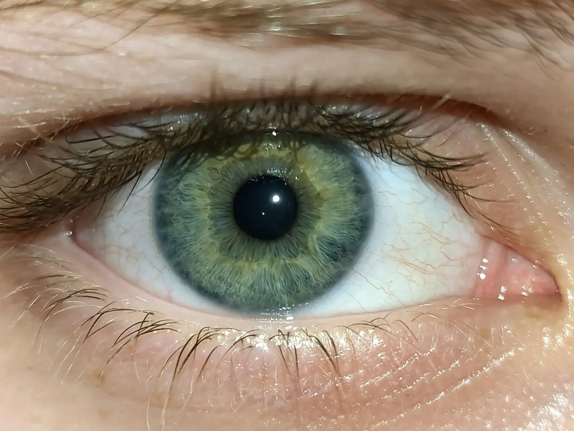 Why Are Green Eyes the Rarest of the Rare?