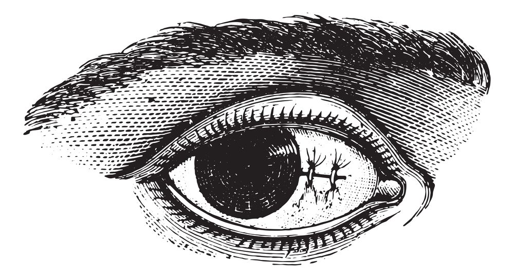 Understanding Eye Web (Pterygium): Find Effective Ways to Prevent and ...